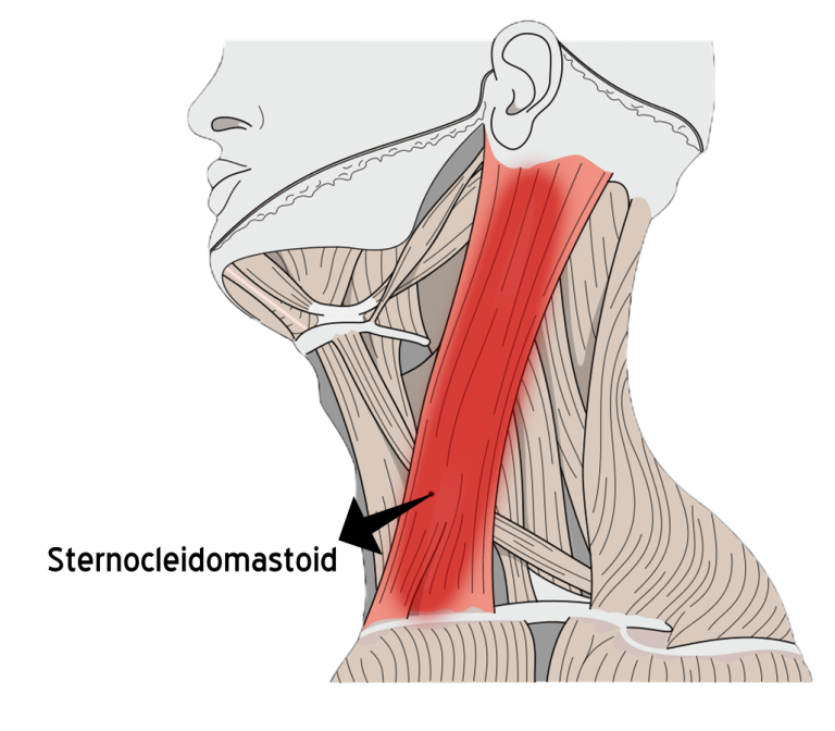 How To Do Weighted Lateral Neck Flexion | Train Your Neck